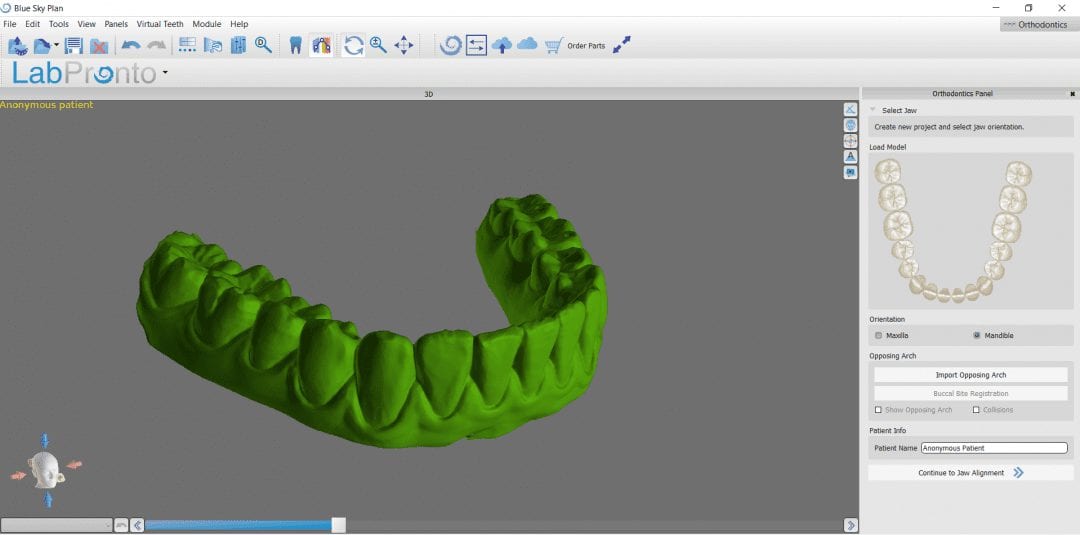Full Arch Scan and Clear Orthodontic Retainer for Minor Tooth Movement ...
