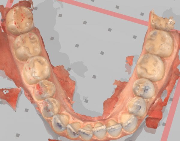 occlusion marks | CAD-Ray.com