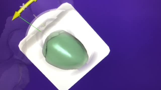 nesting video for digital dental restorations | CAD-Ray.com