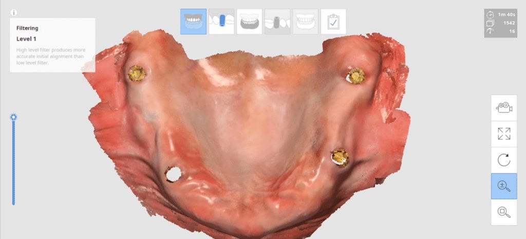 How to Scan an Edentulous Arch in 90 Seconds with the Medit i500 Intra ...