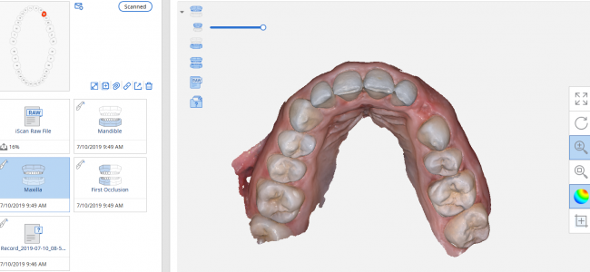 full arch scan for implant planning | CAD-Ray.com
