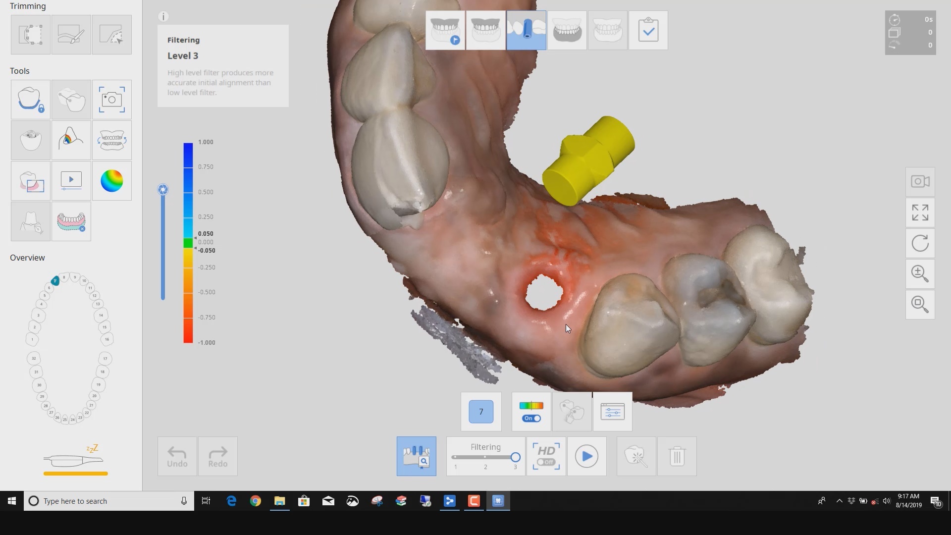 Scanbody Troubles Cad Ray