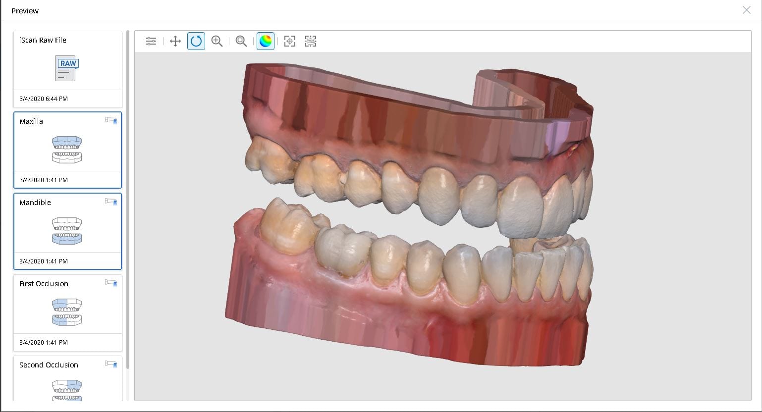 Mounting Upper and Lower Jaws for Obstructive Sleep Apnea Devices ...