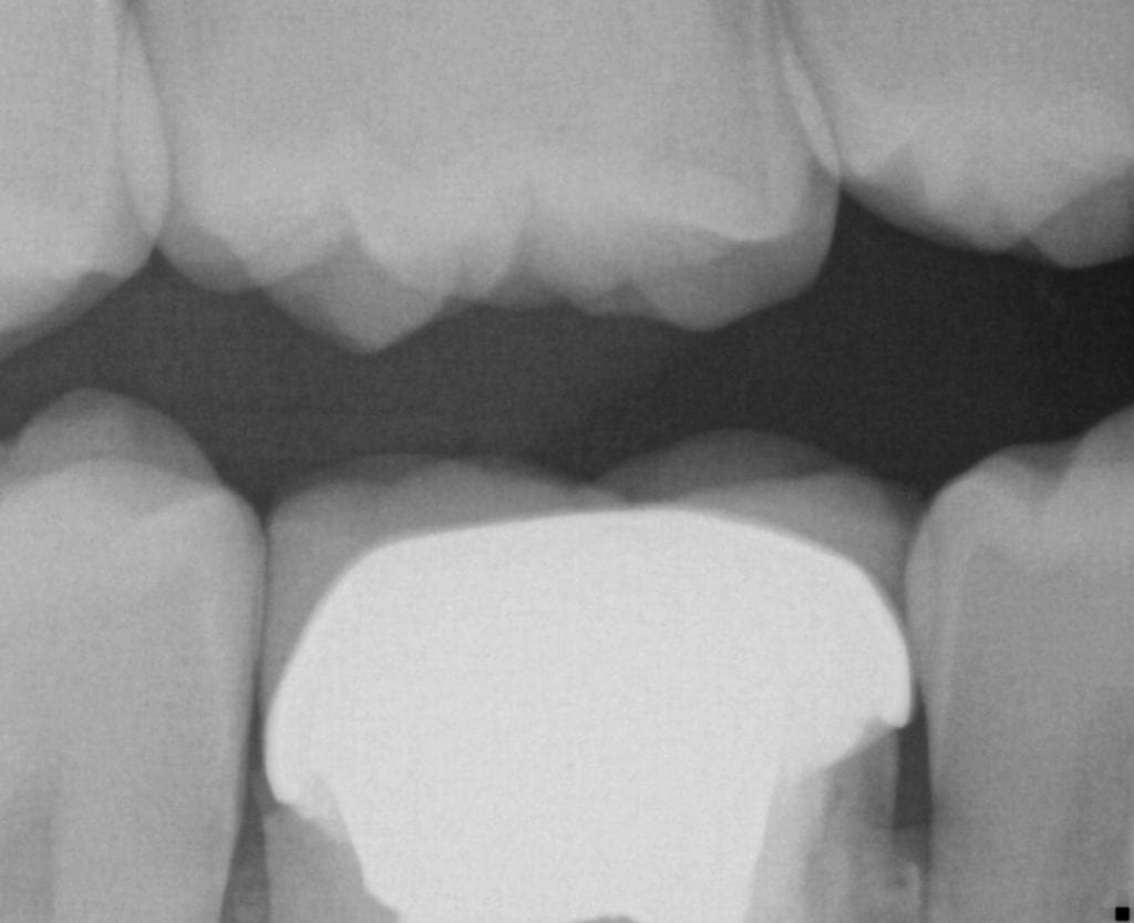 pfm open margins | CAD-Ray.com