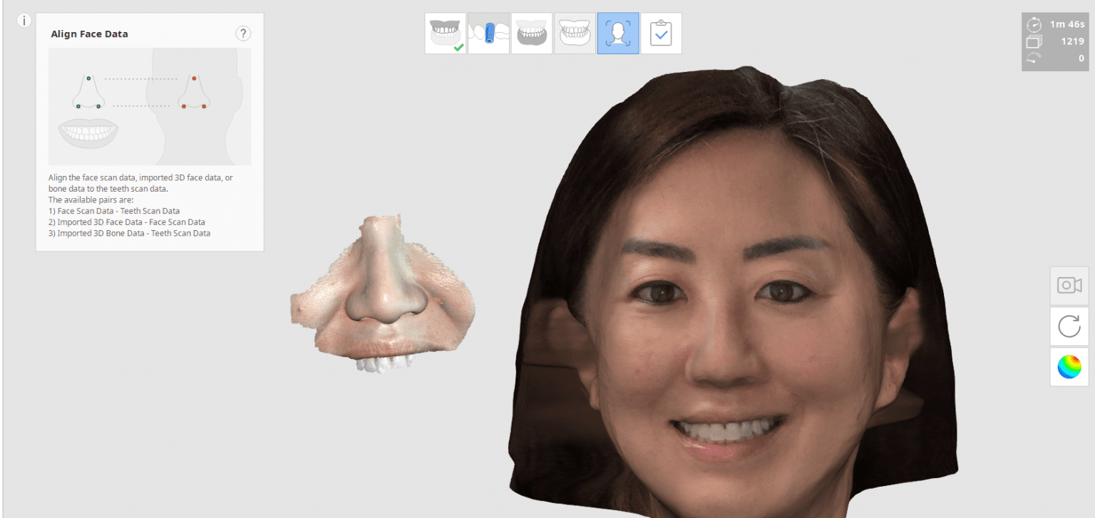Intra-Oral Scan and Face Scan for Smile Analysis | CAD-Ray.com