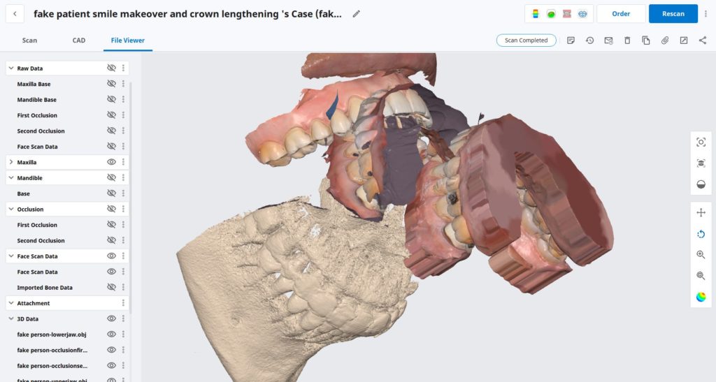 Digital Impressions Archives | CAD-Ray.com