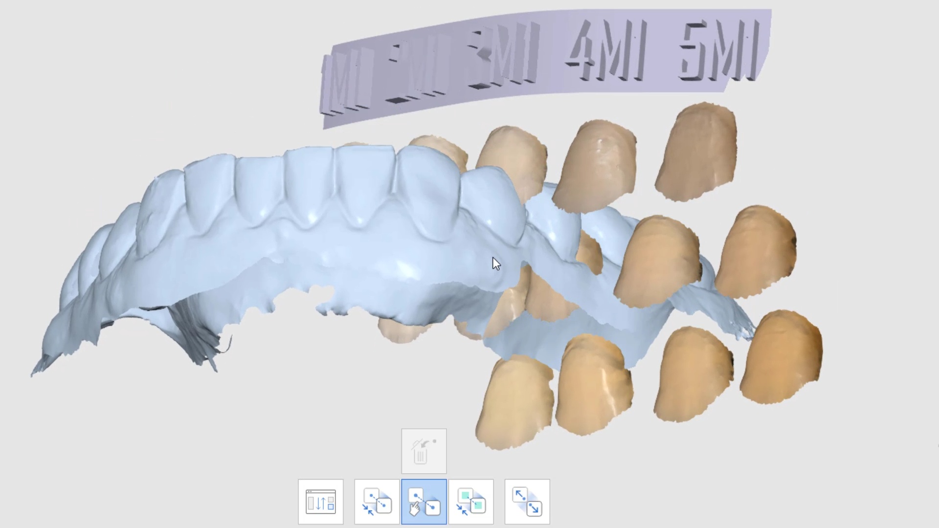 Medit i700 Archives | CAD-Ray.com